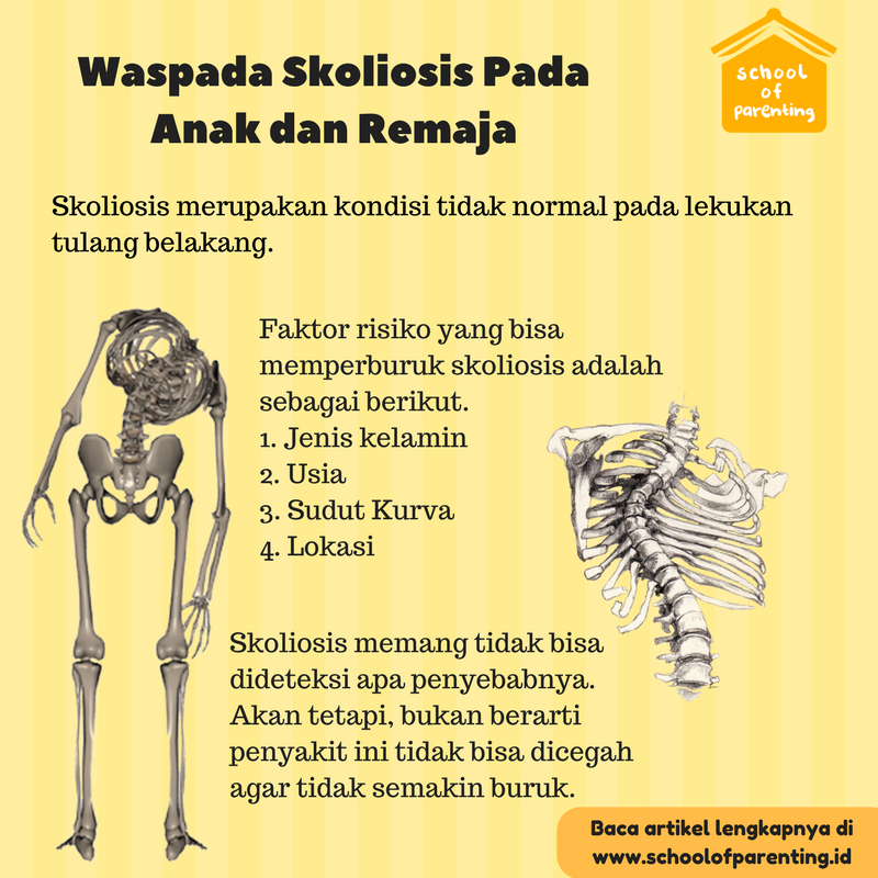 Waspada Skoliosis Pada Anak dan Remaja! - School of Parenting